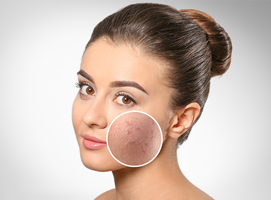 מוצרי ביופור - Biofor Products